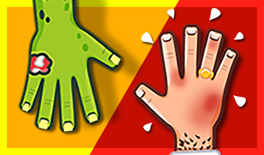 Extreme Hand Slap (by RHM Interactive): Play Online For Free On Playhop